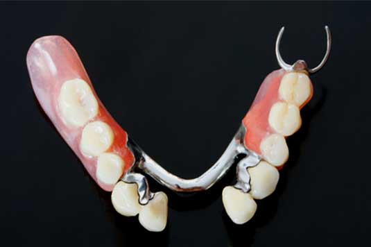 PROTESI DENTARIA | Studiodontoiatrico Zini e Associati